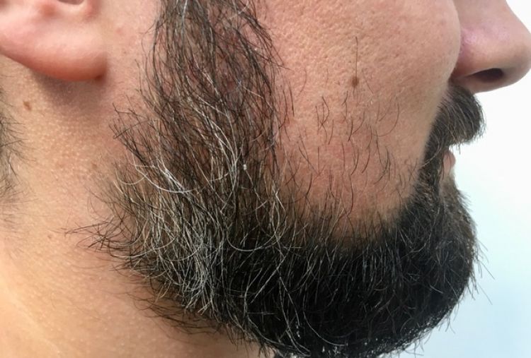 How Can I Bleach My Beard – A Friendly Guide to Help You – My Beard Gang